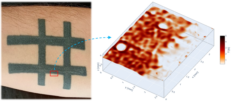 Biomedical Optics Ijs Department Of Complex Matter